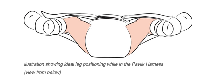 Pavlik - Carrying Matters