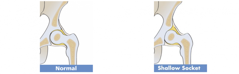 Healthy hips matter; a discussion of what we really know on this topic