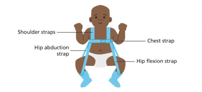 Healthy hips matter; a discussion of what we really know on this topic