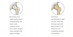 Healthy hips matter; a discussion of what we really know on this topic